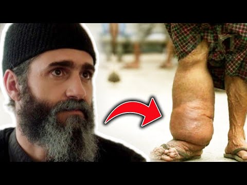 Δείτε ο Αγιος ΠΑΪΣΙΟΣ τι έκανε σε ΑΣΘΕΝΗ με ΕΛΕΦΑΝΤΙΑΣΗ !! - YouTube