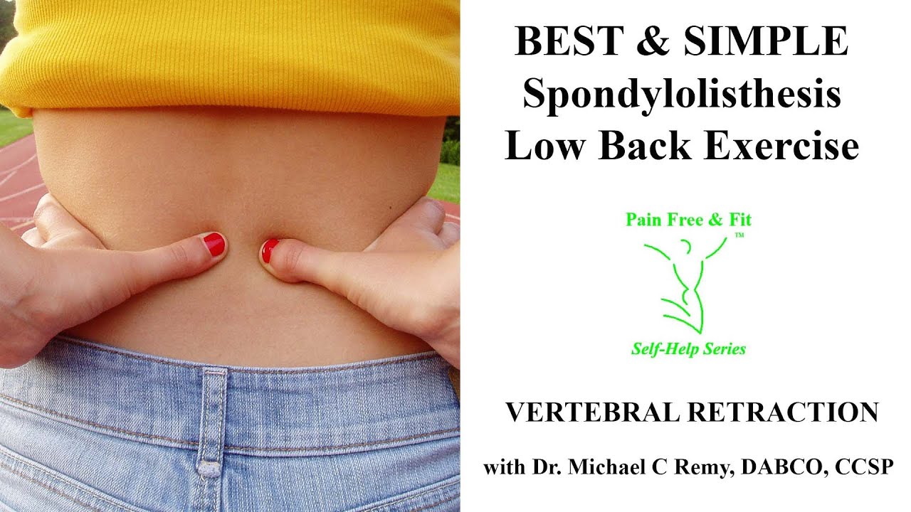 Best and Simple Spondylolisthesis Exercise - YouTube