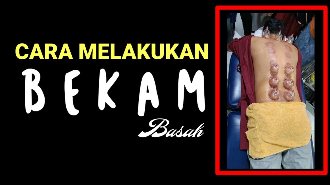 CARA MELAKUKAN BEKAM BASAH / PELATIHAN - YouTube