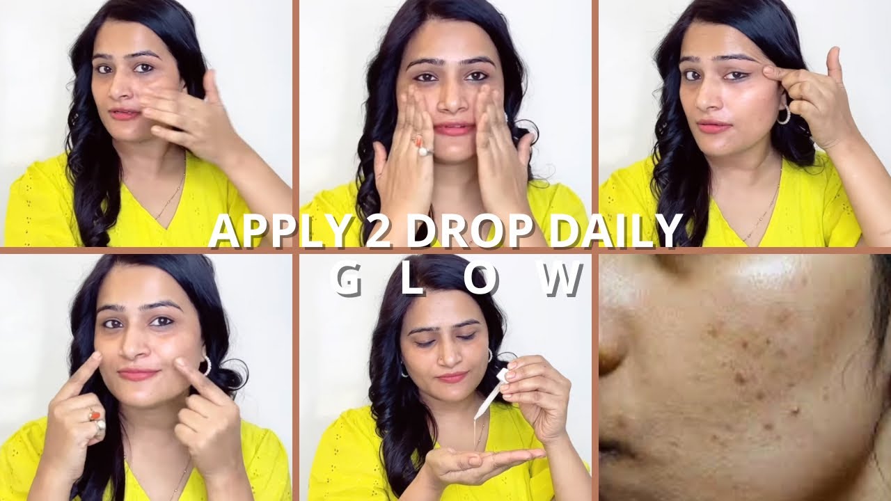 Apply 2 Drops Daily & Get Glowing Skin| Get Spotless Clear & Bright ...