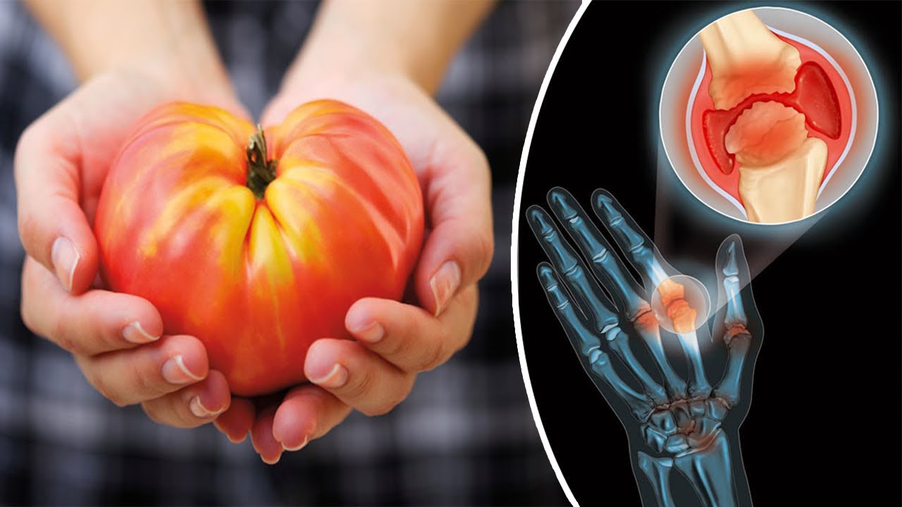 Kuron astmën, pastron mushkëritë, forcon kockat, përdoreni domaten në ...