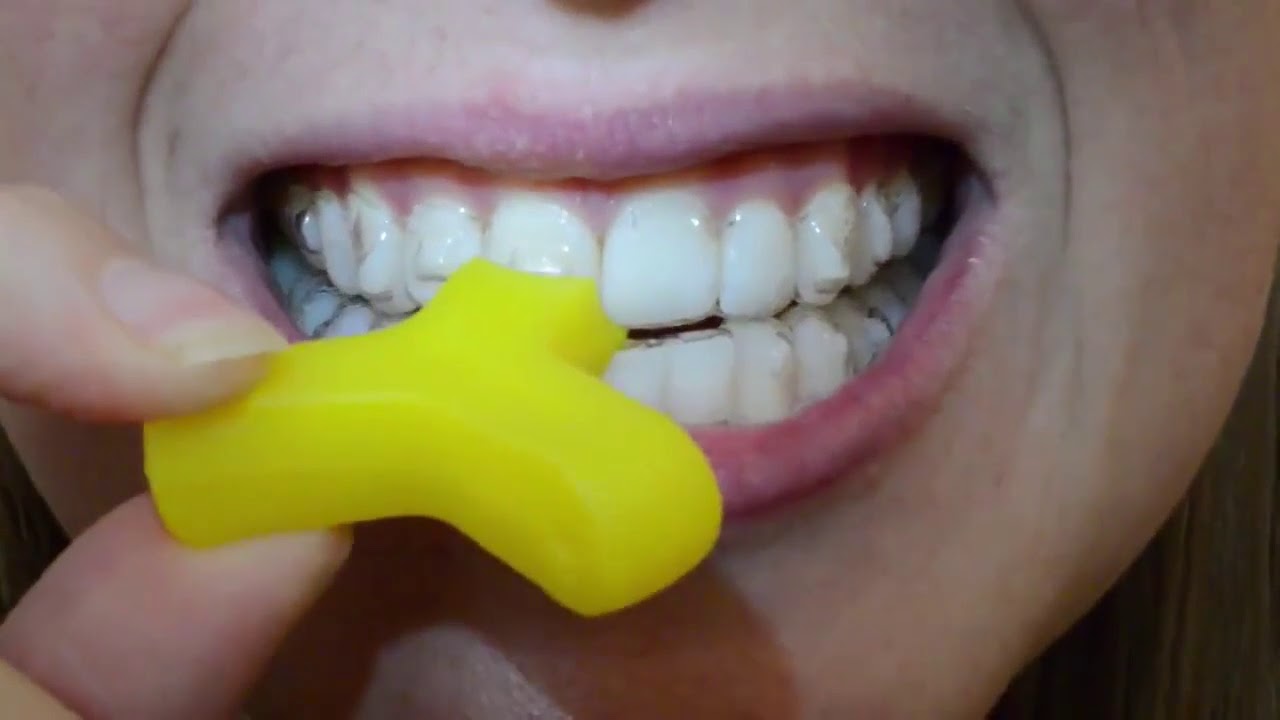 Aligner seating with Munchies® - YouTube