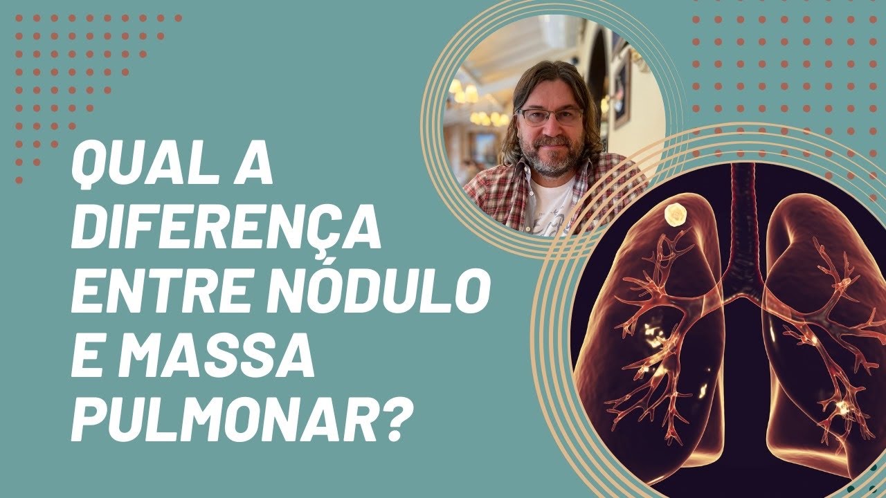 Qual a diferença entre nódulo e massa pulmonar? - YouTube