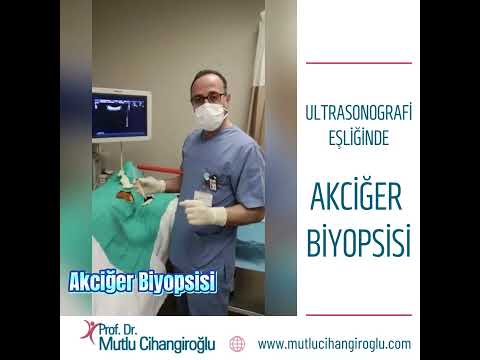 ULTRASONOGRAFİ EŞLİĞİNDE AKCİĞER BİYOPSİSİ