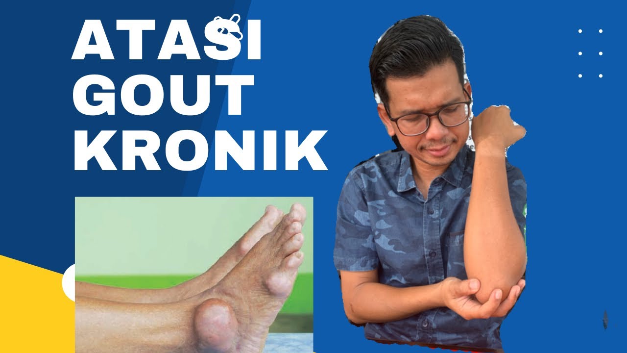 Bagaimana Nak Atasi Masalah Gout Yang Kronik? #suplimengout - YouTube