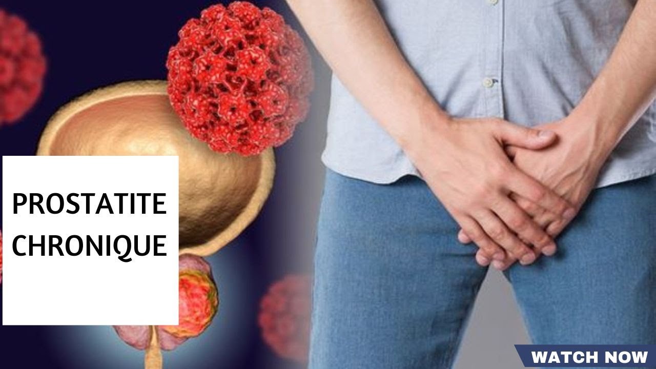 PROSTATITE CHRONIQUE - YouTube