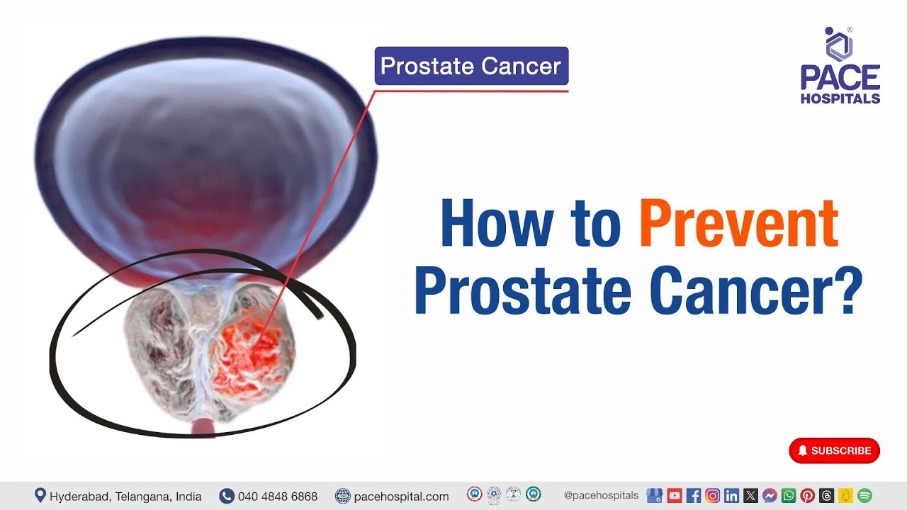 Prostate Cancer Prevention | How to Prevent Prostate Cancer? | # ...