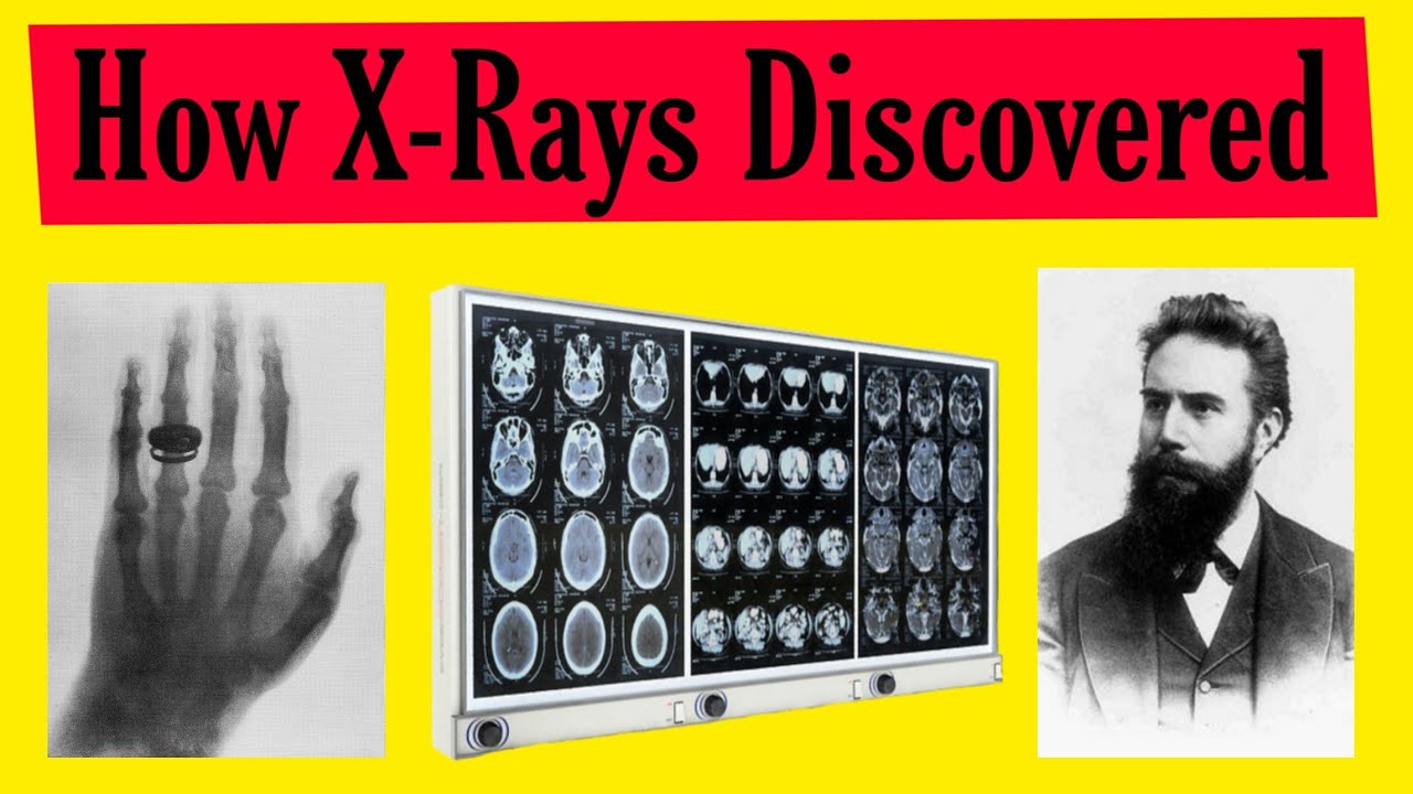 Discovery Of X-Rays in Hindi | Radiology Classes | X Ray Courses | How ...