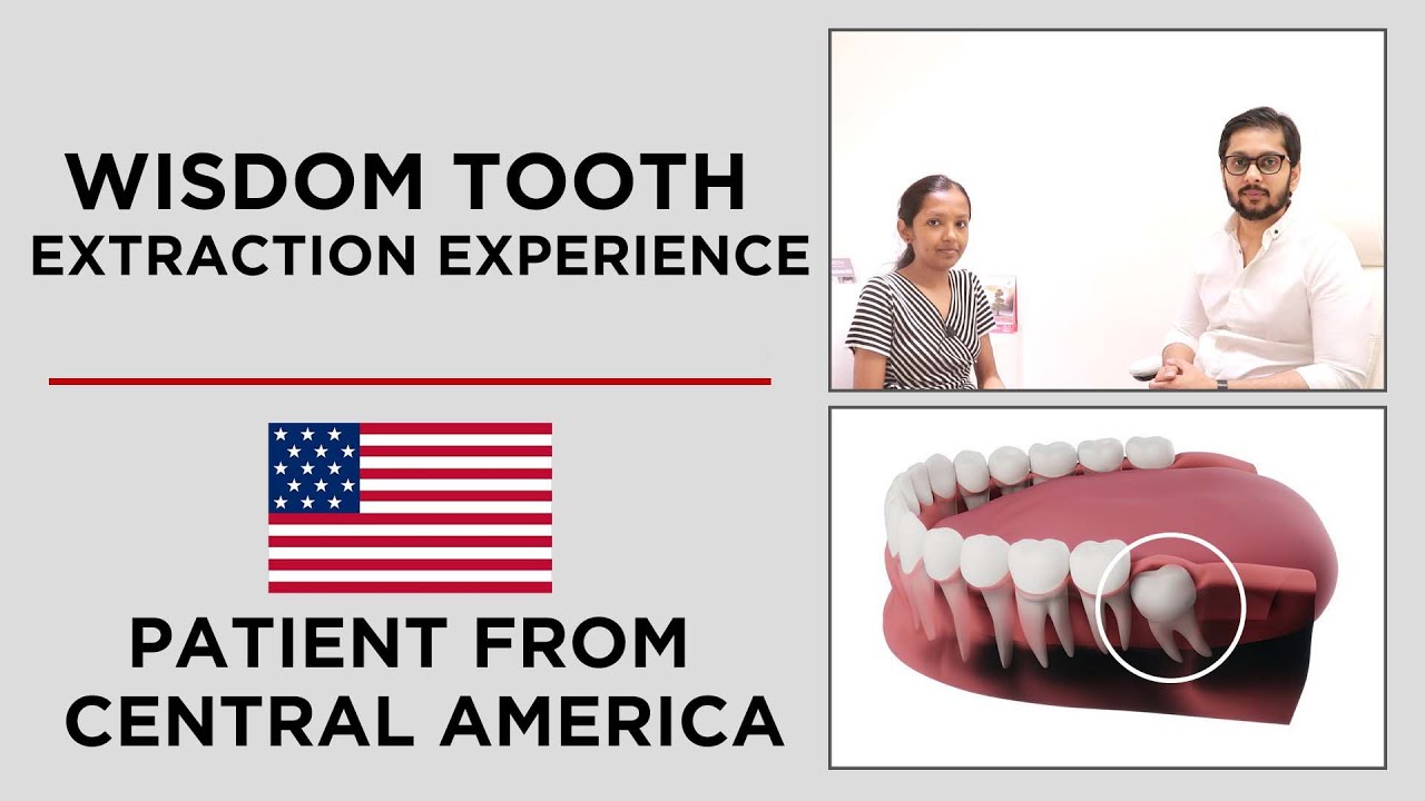 Wisdom Tooth Extraction Experience| Patient from Central America | Dr ...