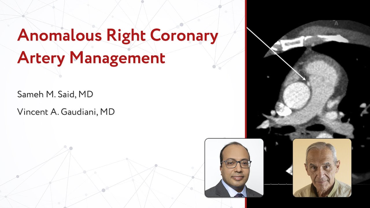 Anomalous Right Coronary Artery Management: An Exploration With Sameh ...