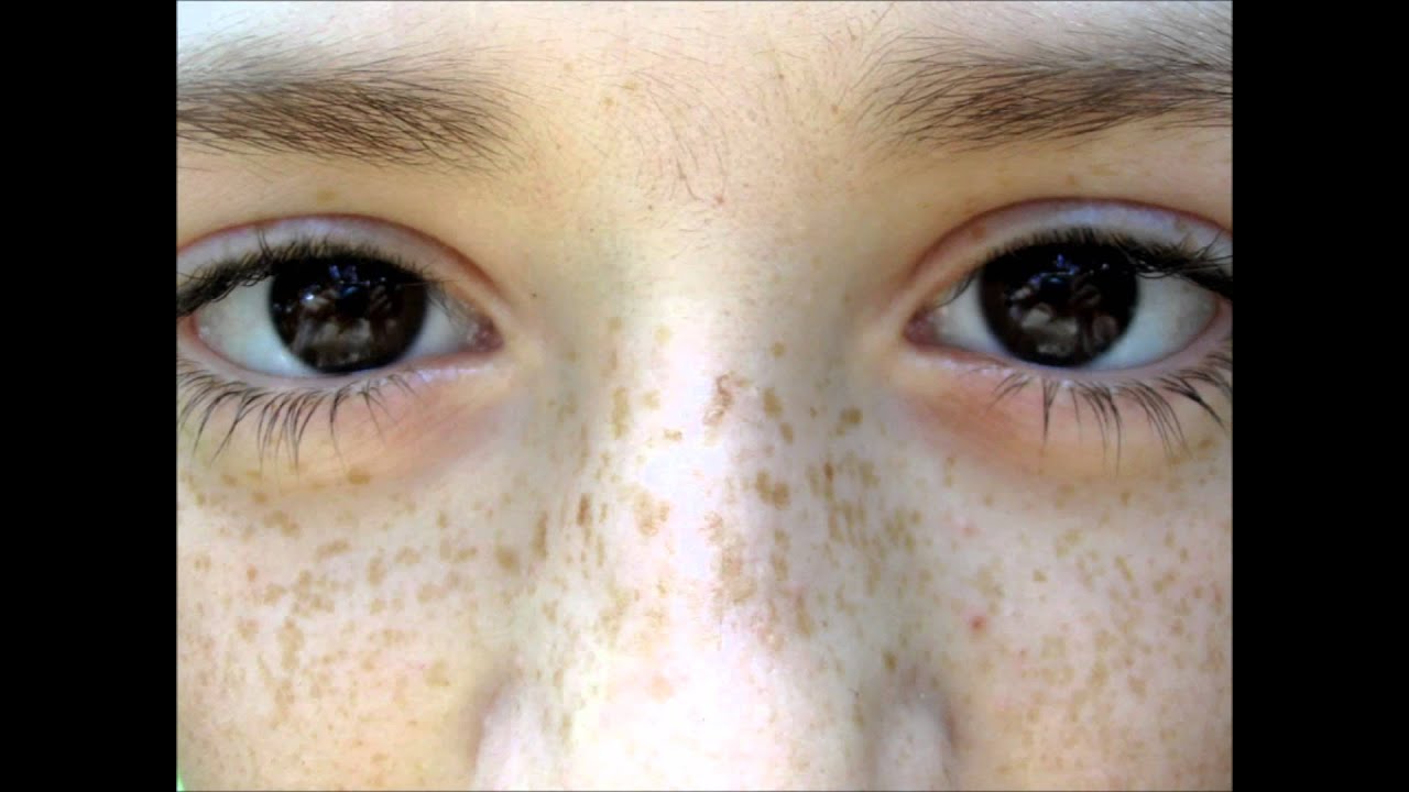 piegus (freckled) - YouTube Music