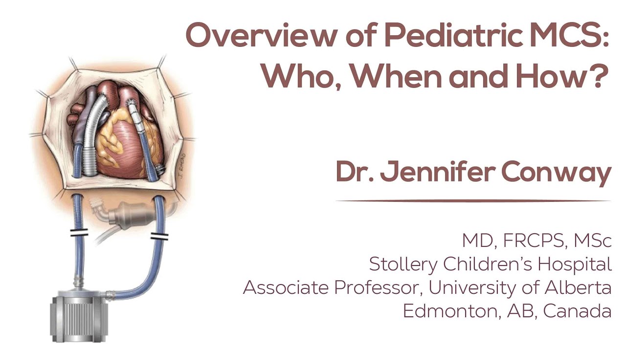 Overview of Pediatric MCS: Who, When and How? - YouTube