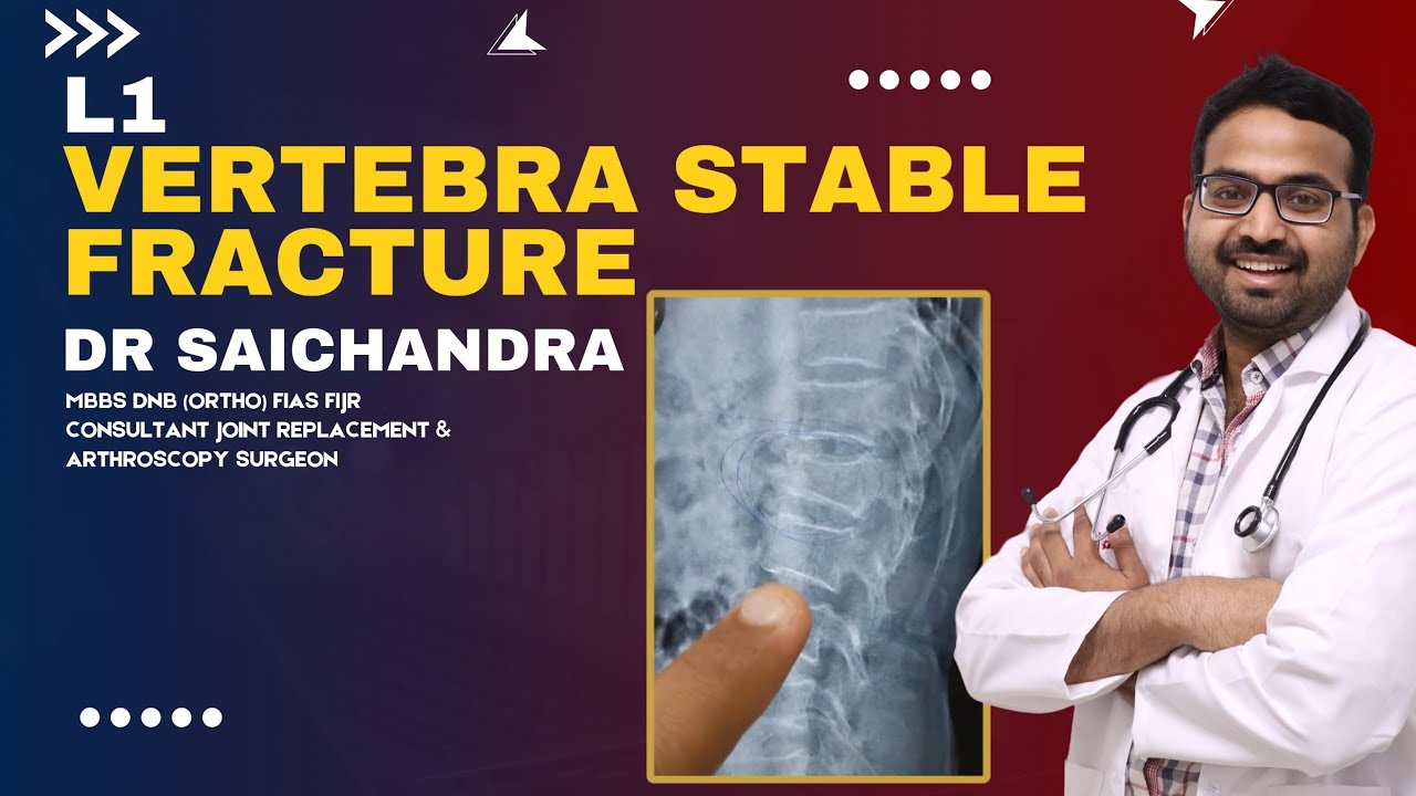 L1 Anterior Wedge Compression Fracture..Dr Sai Chandra - YouTube