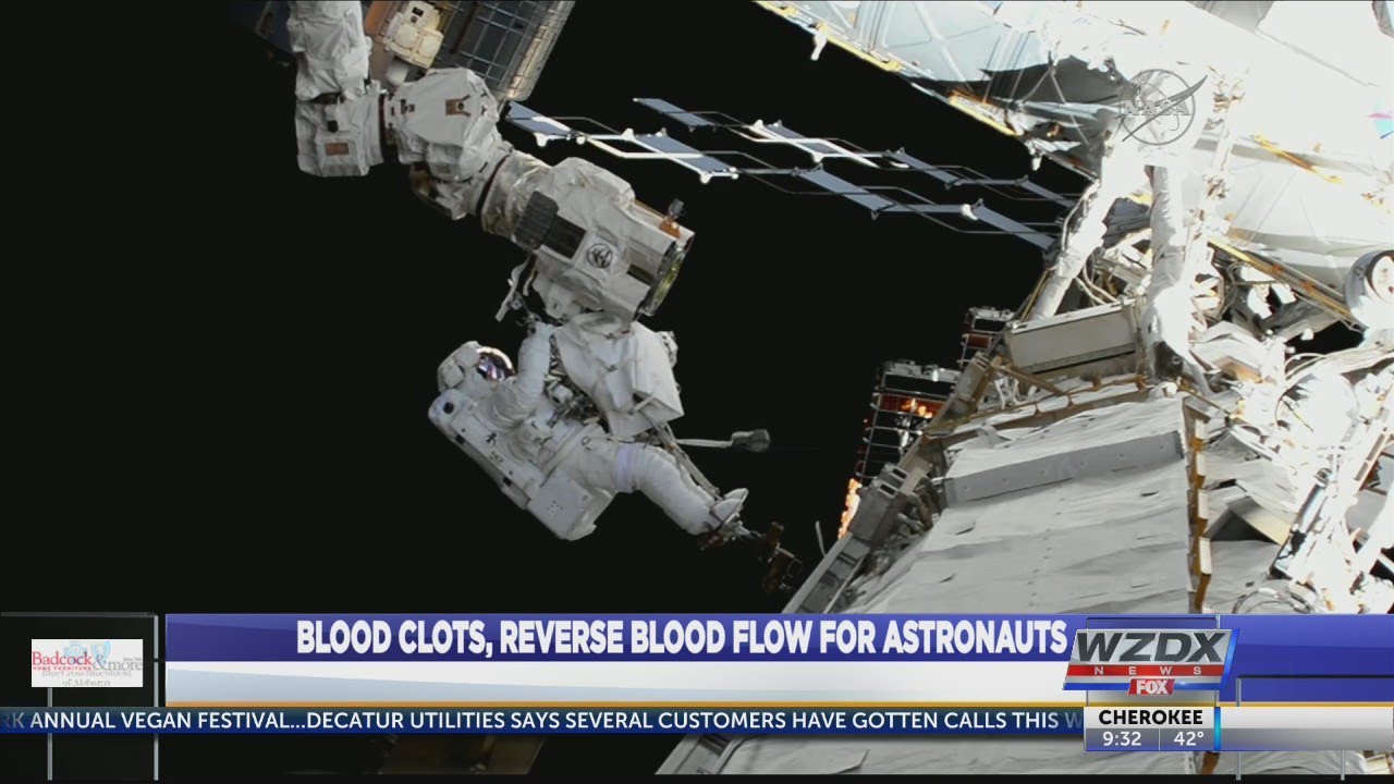 Blood clots, reverse blood flow found in astronauts - YouTube