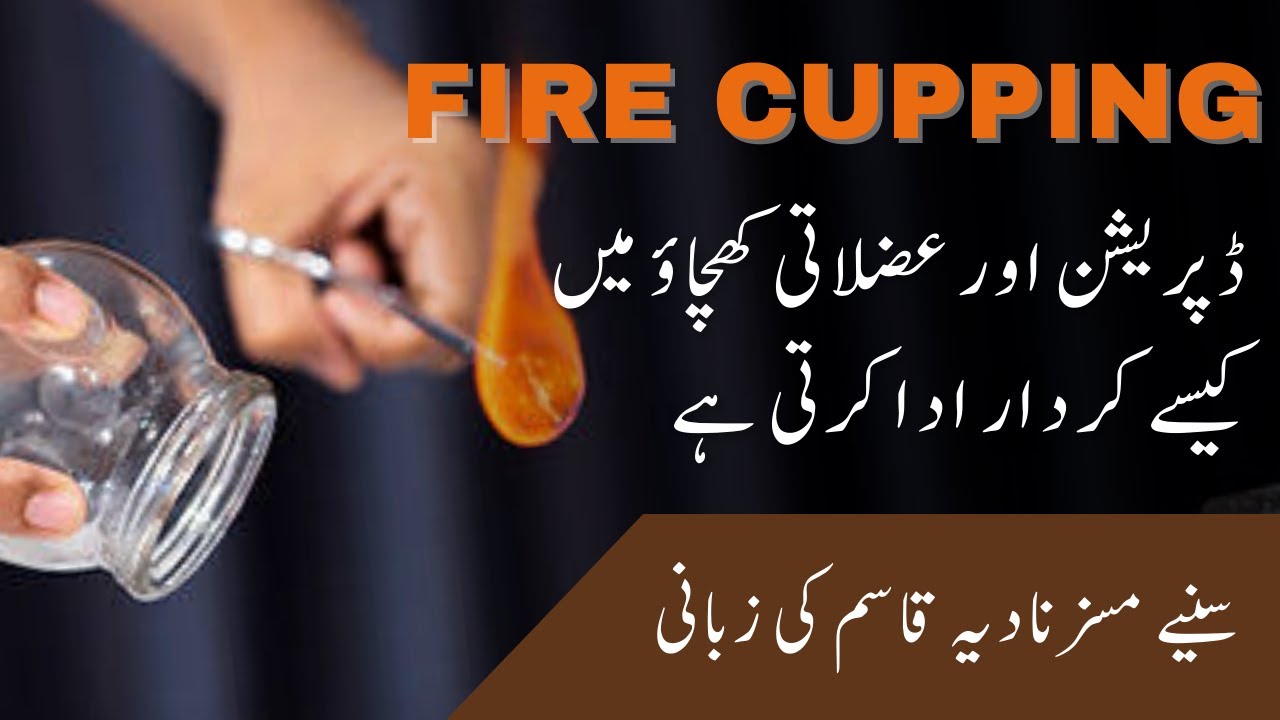 Nadia Qasim Shares Her Experience with Fire Cupping for Depression and ...