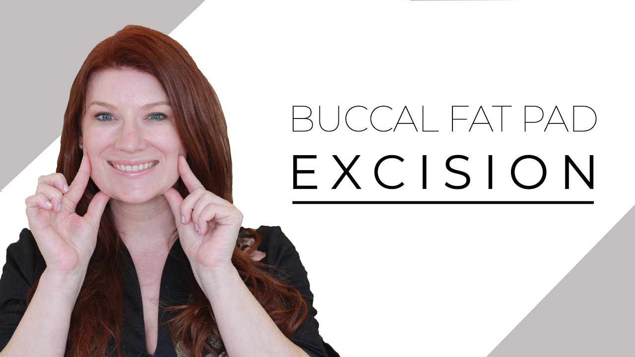 What is Buccal Fat Pad Excision with Dr. Sarah Saxon - YouTube