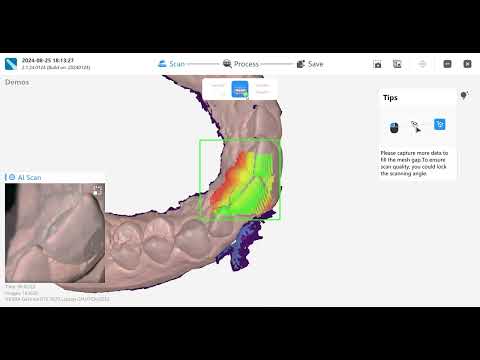 fonction d'acquisition - Elephant V3+ Scanner - YouTube
