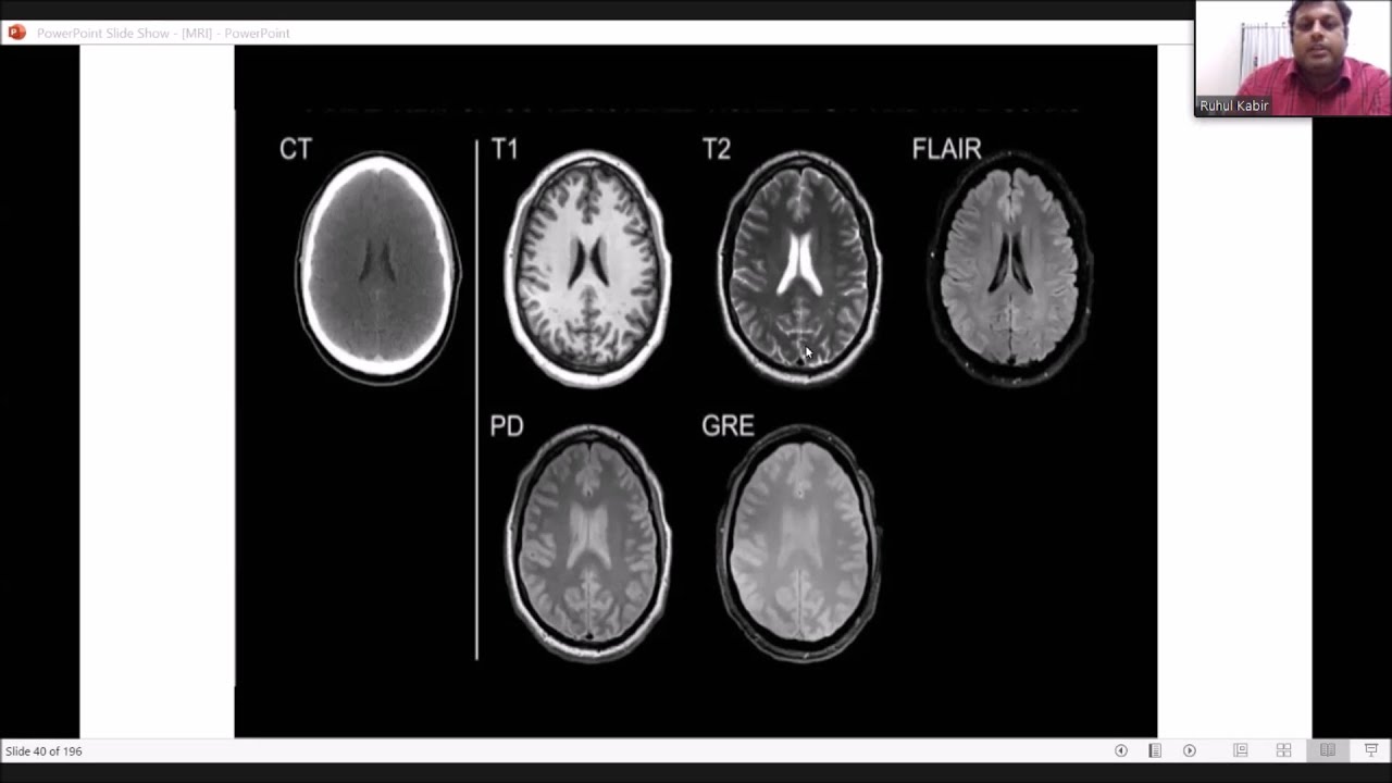 MRI Brain- Basics by Dr. Mohammed Ruhul Kabir sir - YouTube