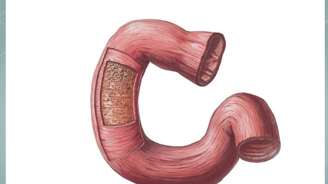 ¿Qué es el duodeno? - YouTube