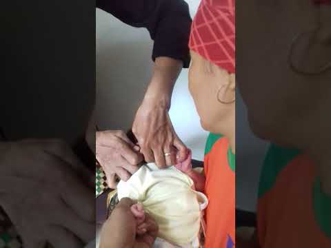 Tindik Bayi Extrim Cara Kuno