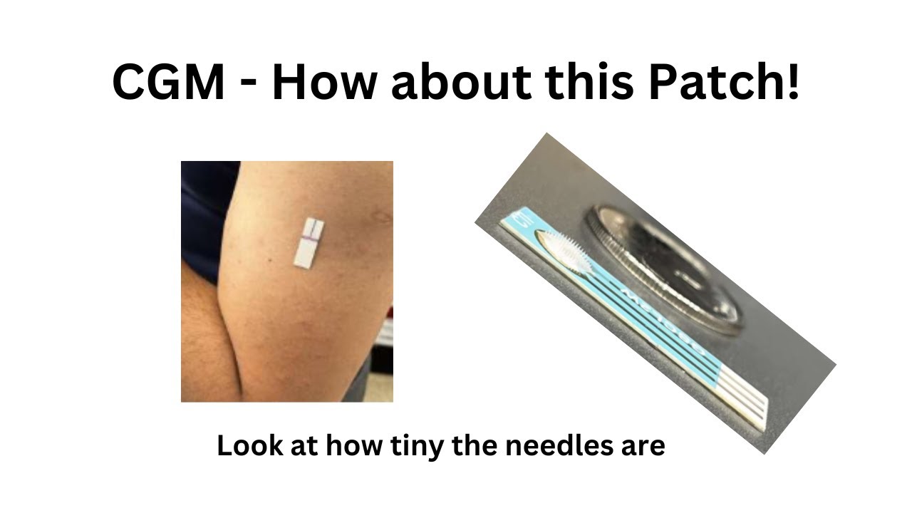 Continuous Glucose Monitoring Patch! - YouTube