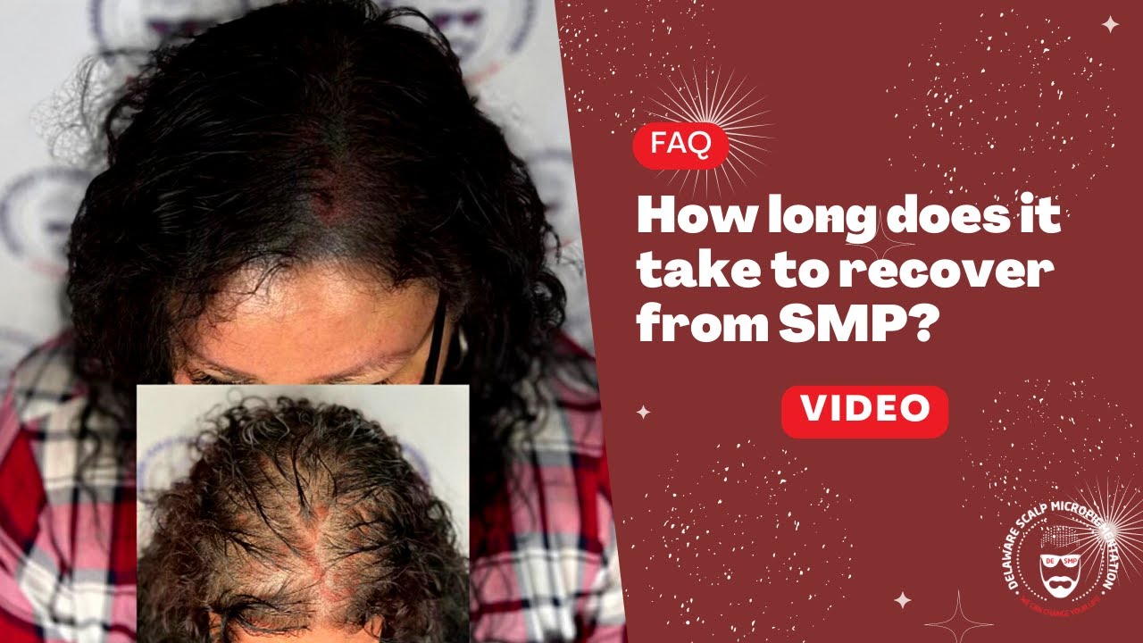 How Long Does It Take to Recover from SMP? - YouTube