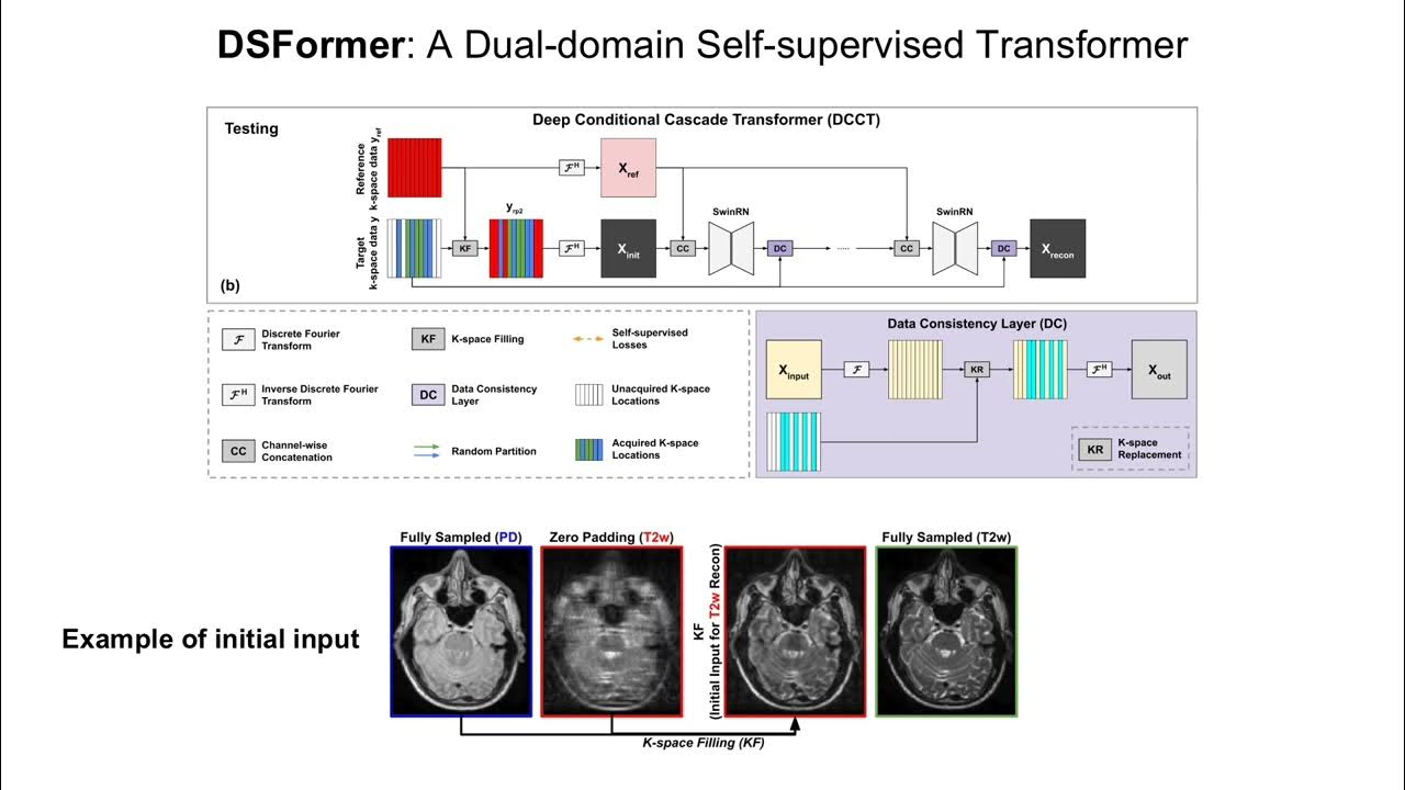 DSFormer: A Dual-domain Self-supervised Transformer for Accelerated Multi-contrast MRI ...