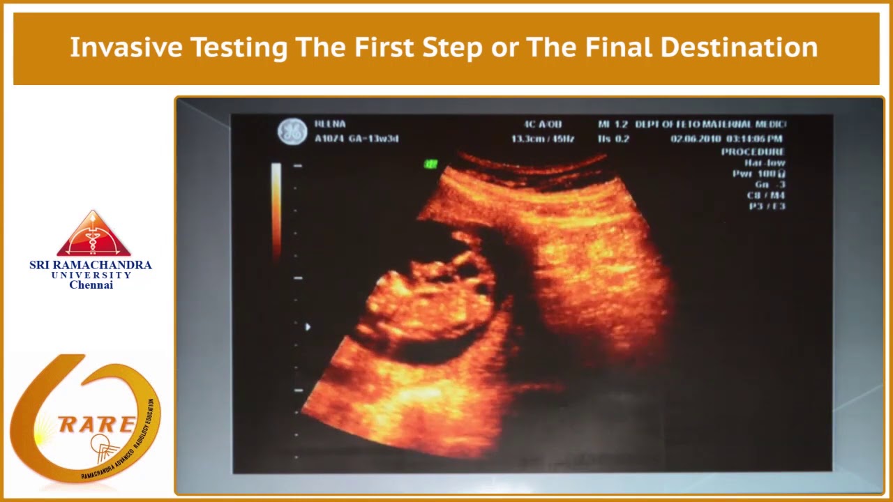 Invasive Testing The First Step or The Final Destination - YouTube