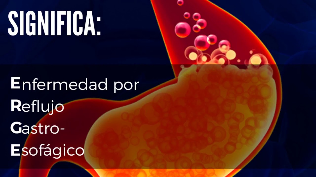 ¿Qué es el ERGE? - YouTube