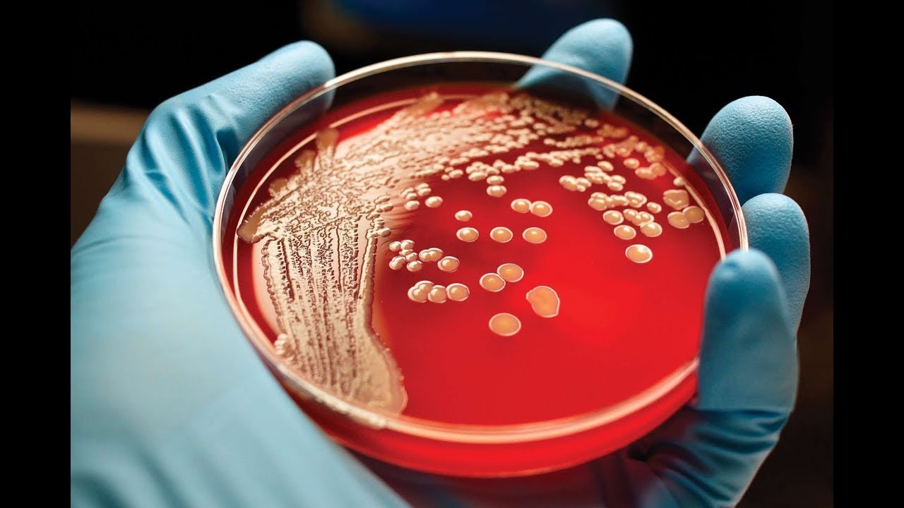 Cleanroom detectives - what microbes can tell us - YouTube