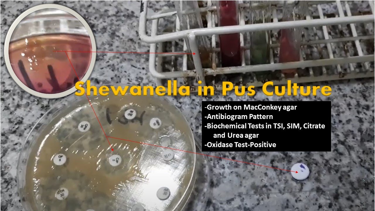 Shewanella species colony morphology and Biochemical Tests - YouTube