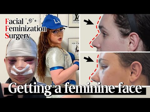 Essential Guide to FFS : Facial Feminization Surgery for Trans 🌈🏳️‍⚧️