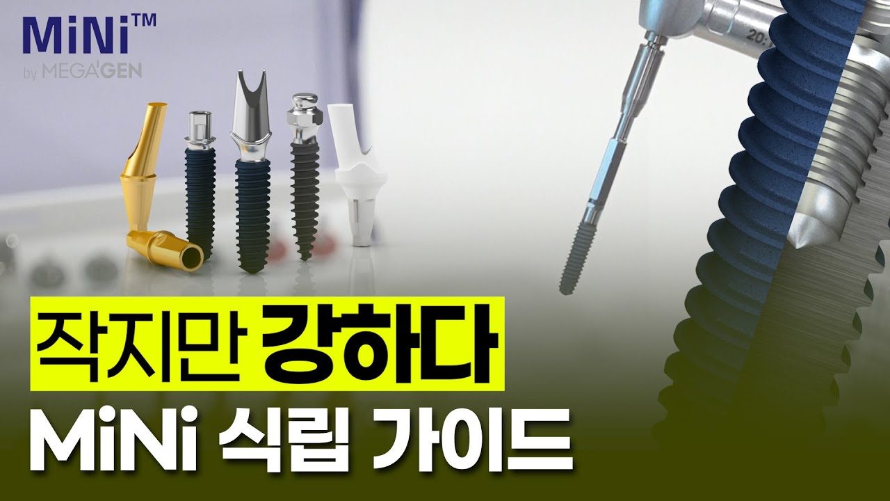 MiNi 식립 가이드(MeGagen MiNi Implant) - YouTube