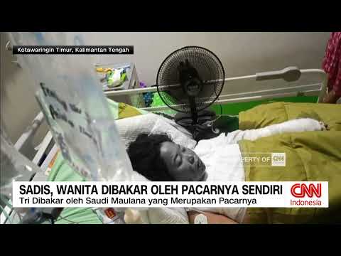 Wanita di Kalimantan Tengah Dibakar Pacar, Alami Luka Bakar di Sekujur Tubuh