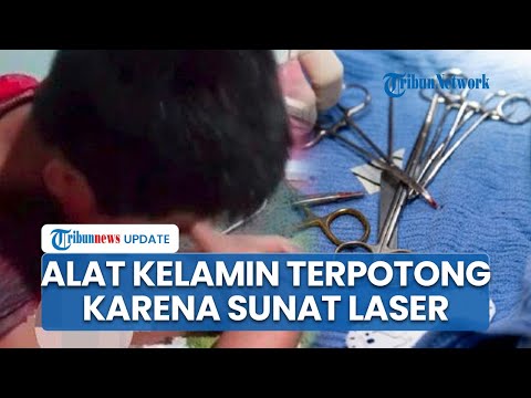 Viral Alat Kelamin Bocah 10 Tahun Terpotong saat Sunat Pakai Laser, Perawat Lari dari Tanggung Jawab