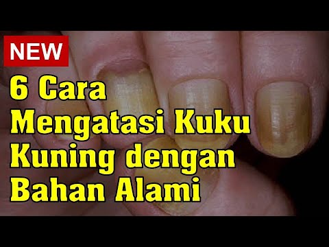 6 Cara Mengatasi Kuku Kuning dengan Bahan Alami - YouTube