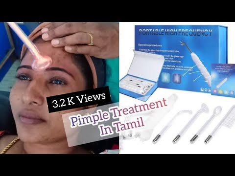 Pimple Treatment using with High frequency machines - YouTube