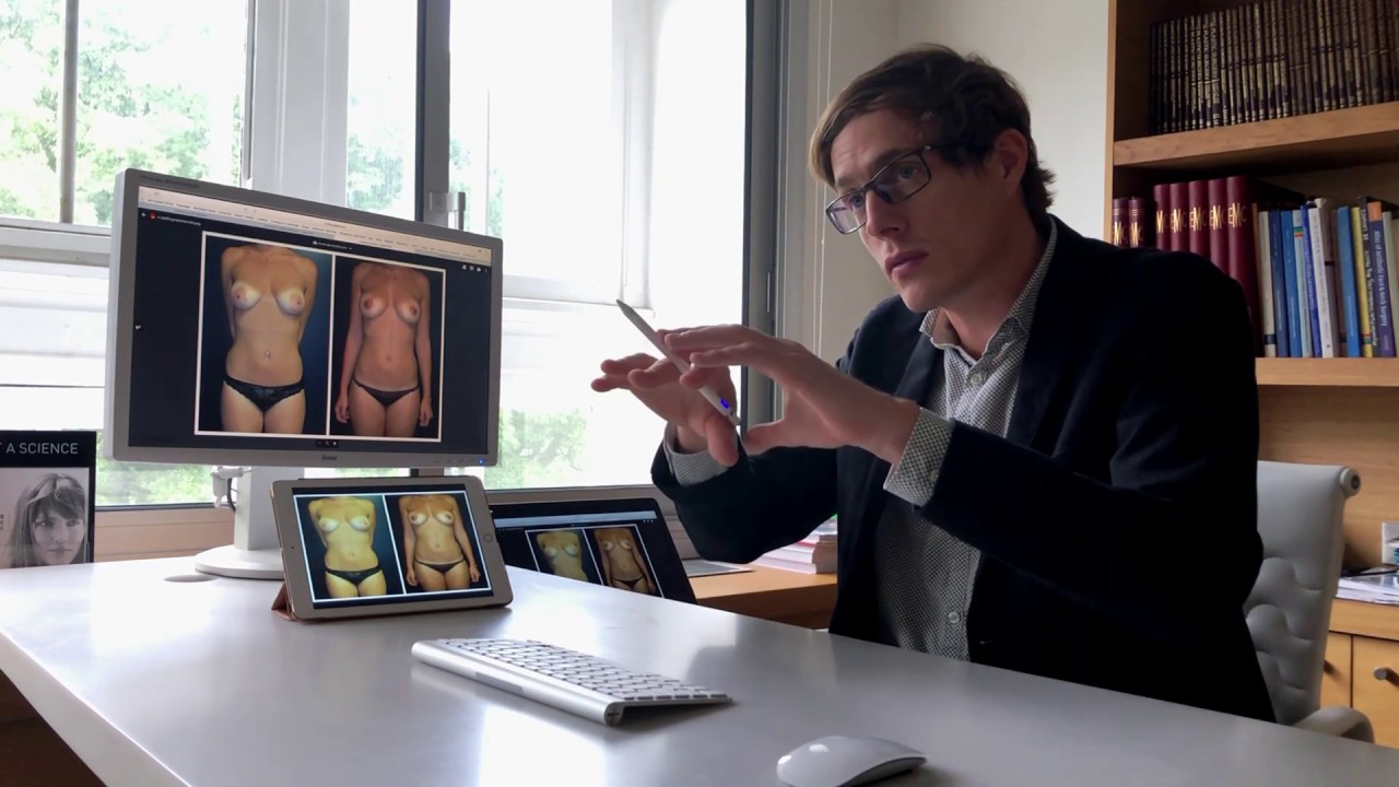 Lipofilling mammaire – Résultats sur différent patients | Avant / Après ...