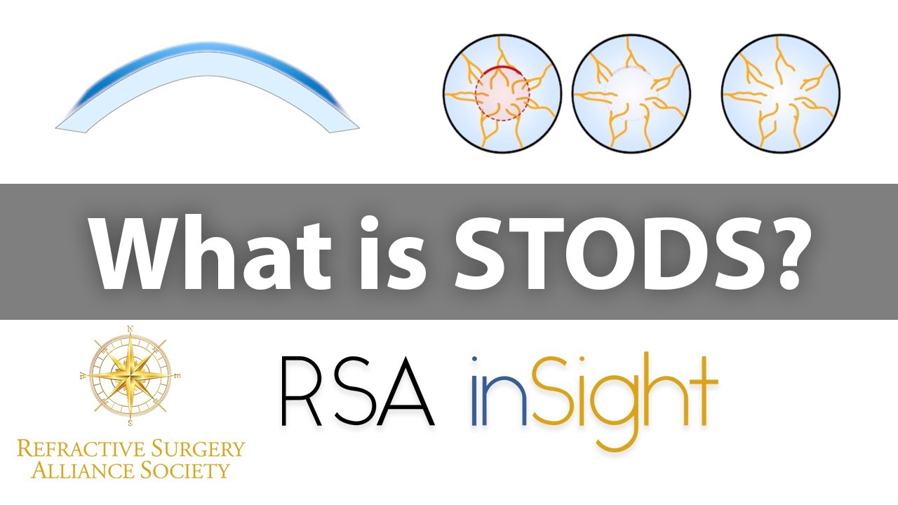 What is STODS? - YouTube