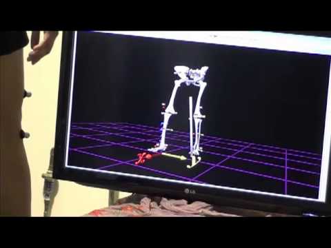 Gait Training with Bertec, Vicon, and The MotionMonitor® - YouTube