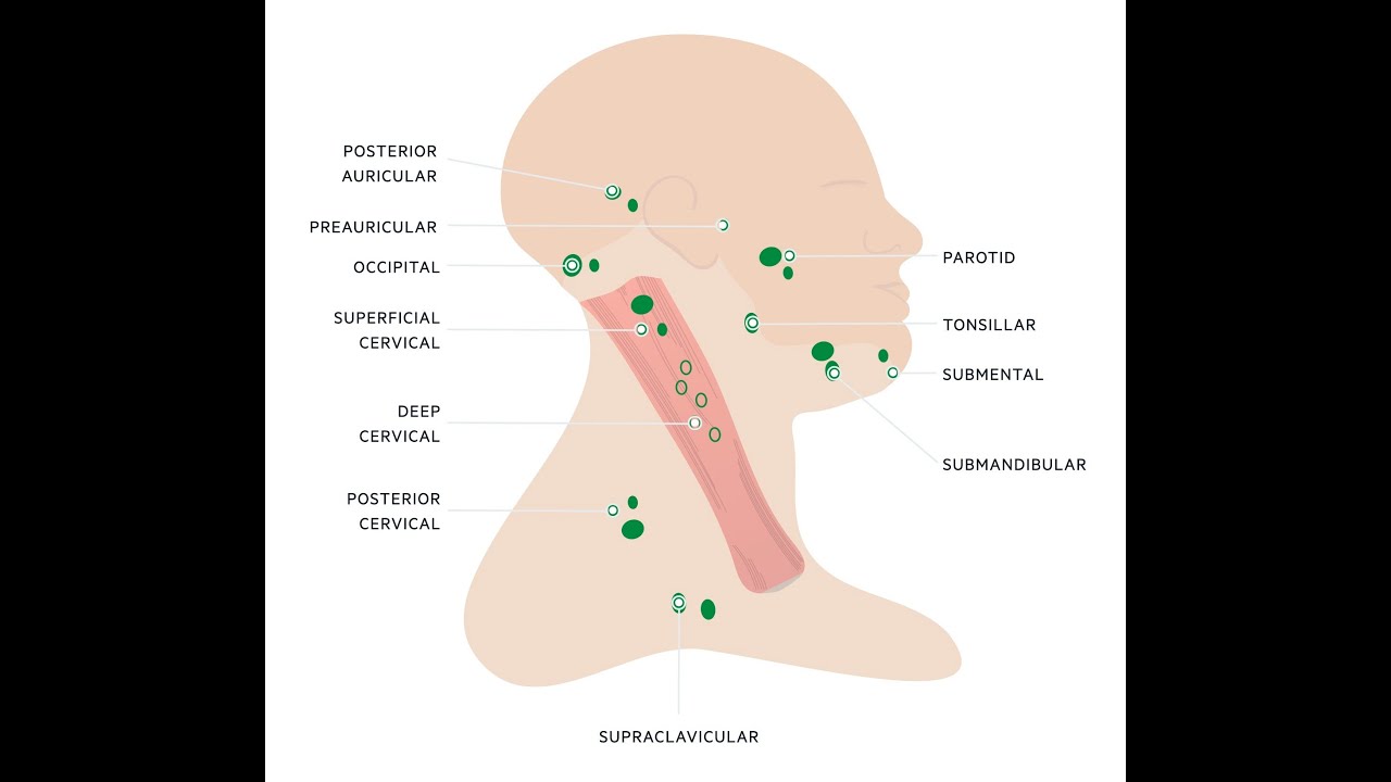 Virchow's Node (Supraclavicular Node) ; Anatomy and Clinical Anatomy ...