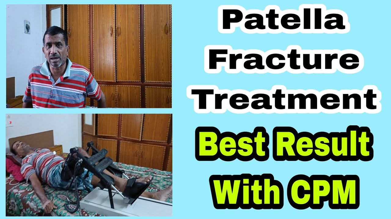Patella Fracture Exercises with CPM @geethamihi - YouTube