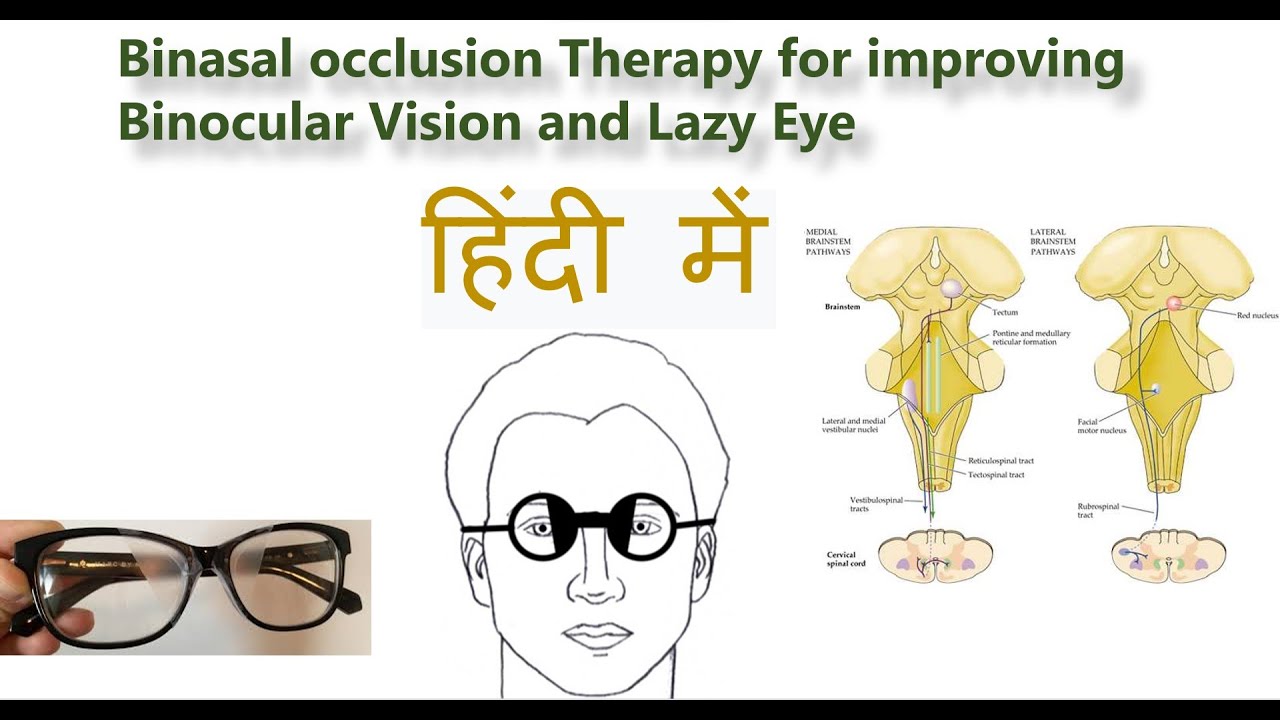 Binasal occlusion therapy in Hindi - YouTube