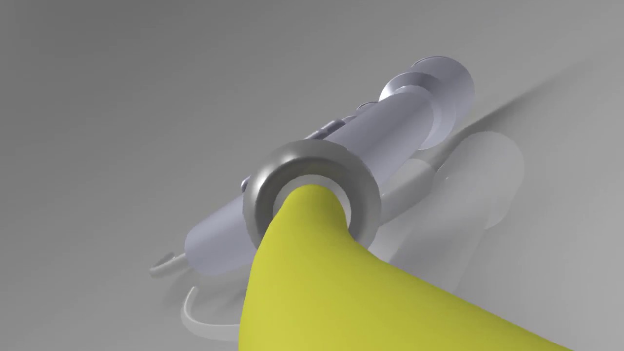 Catheter Manifold animation - YouTube