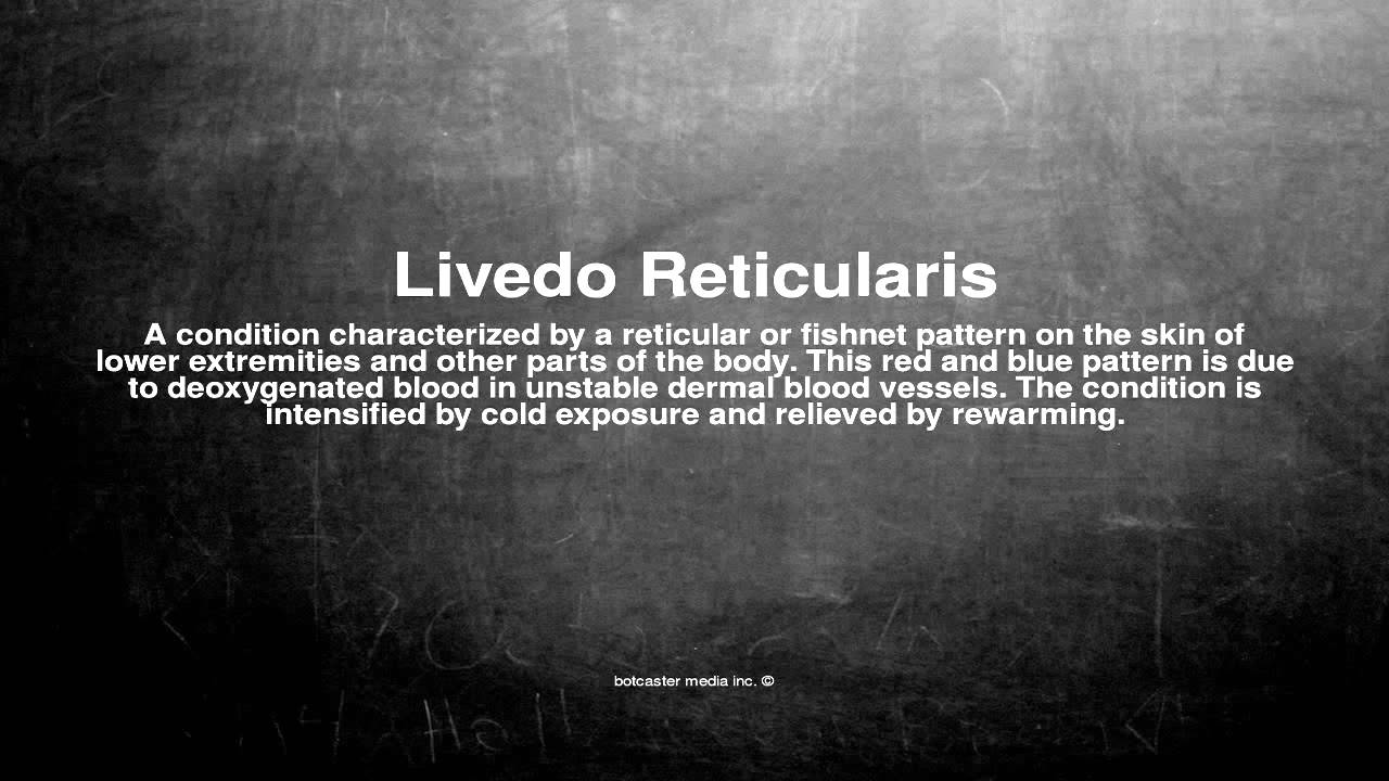 Medical vocabulary: What does Livedo Reticularis mean - YouTube