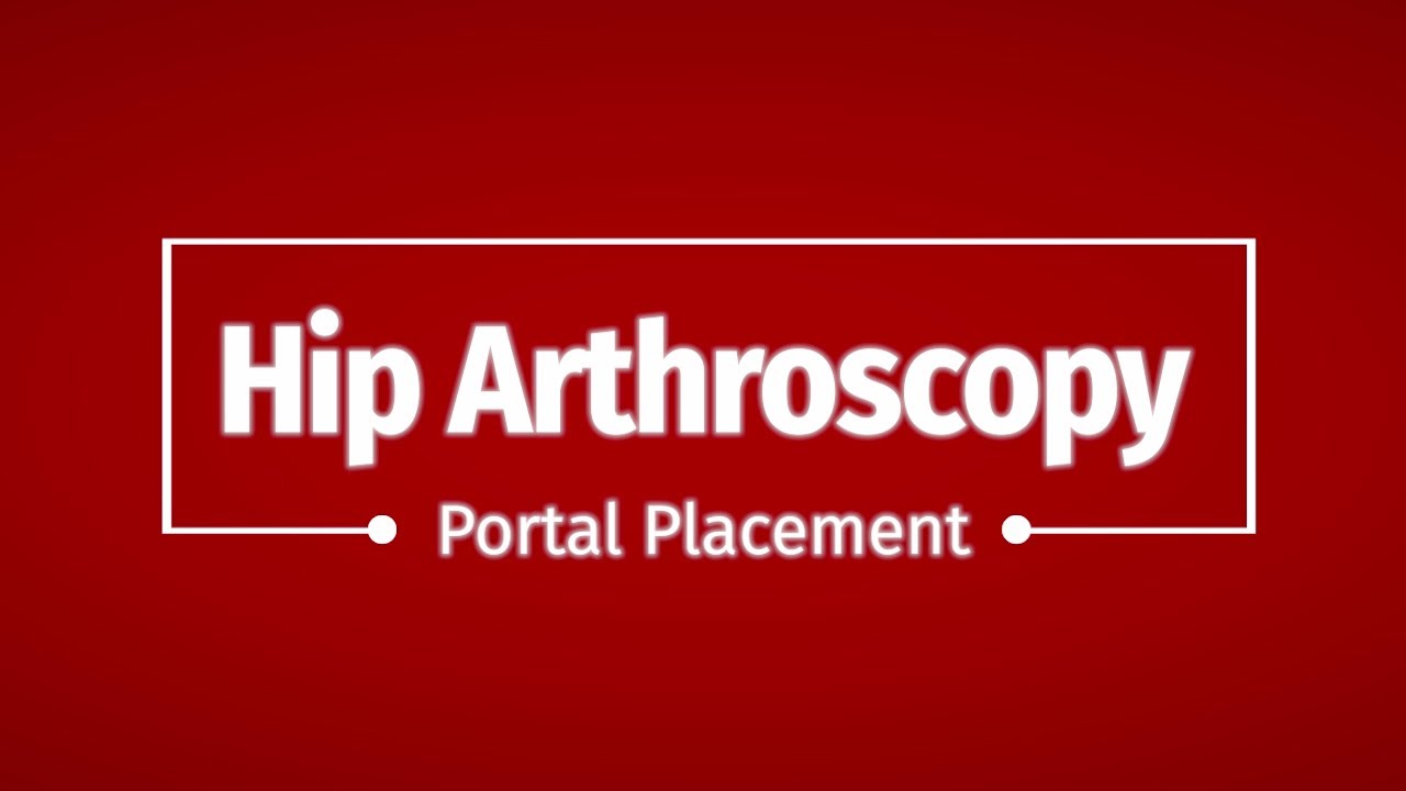 Hip Arthroscopy, Portal Placement - YouTube