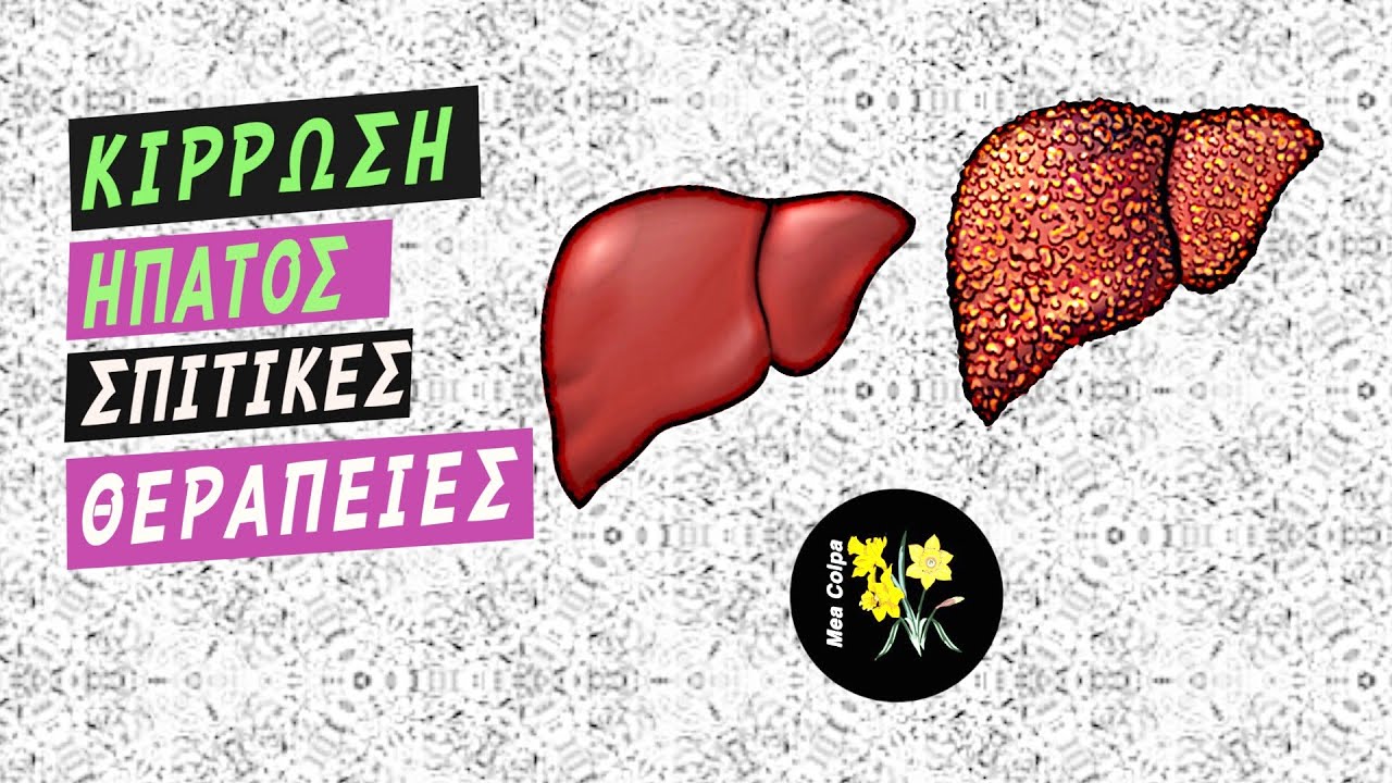 Κίρρωση Ηπατος - Σπιτικές Θεραπείες - YouTube
