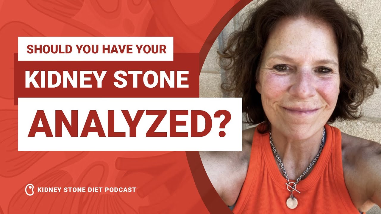 Should you have your kidney stone analyzed? / Kidney Stone Diet Podcast ...
