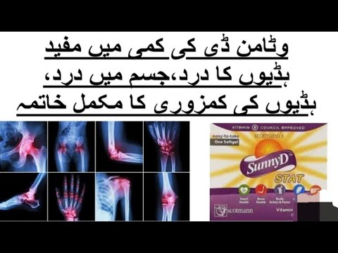 Cap Sunny D stat 20,00000iu uses in urdu(Ansar noor medical media)sunny ...