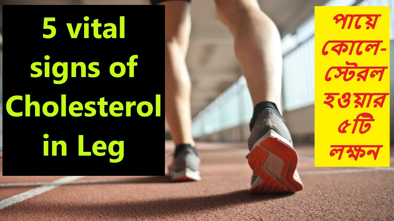 5 signs of high cholesterol symptoms at legs | জানুন উচ্চ কোলেস্টেরলের ...